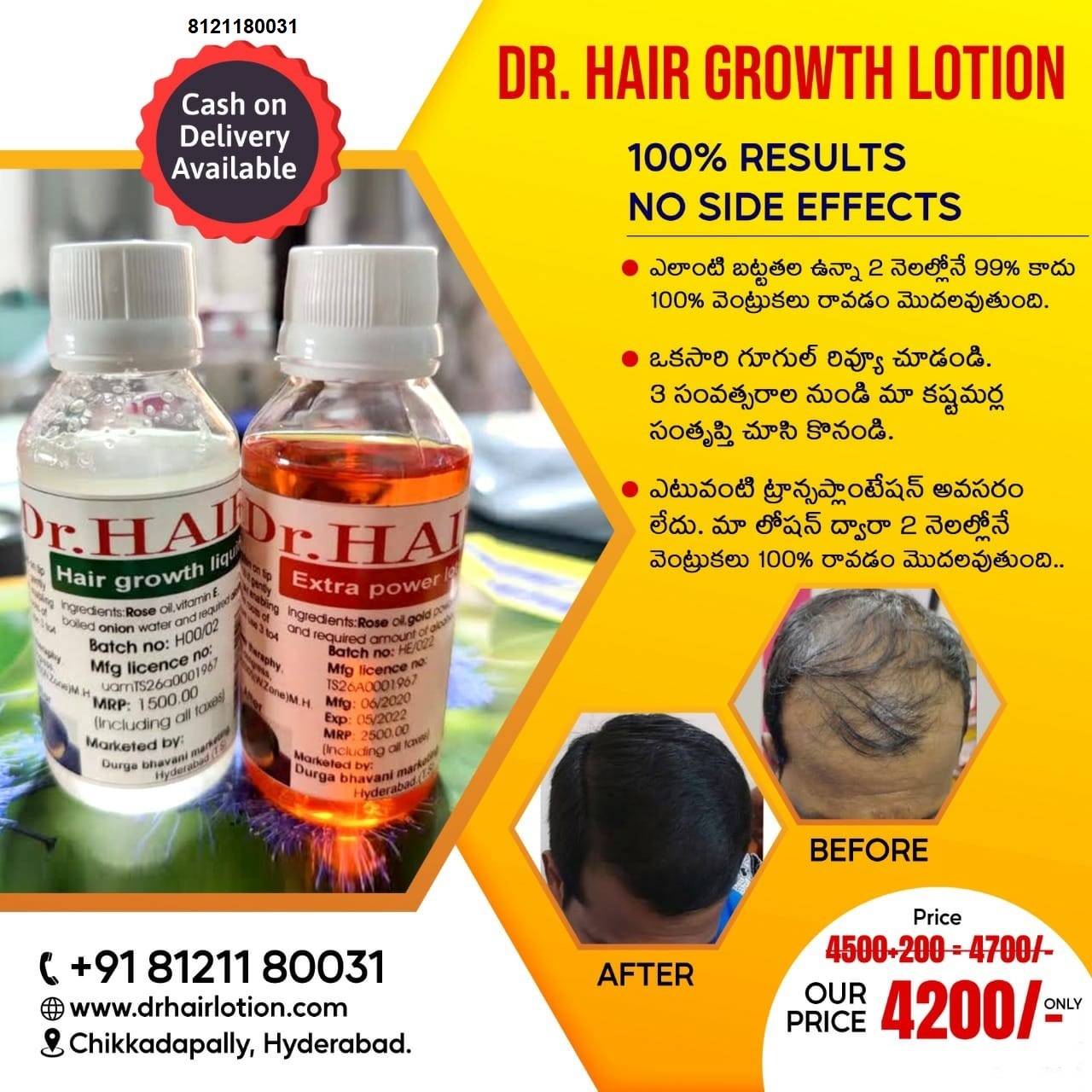 Dr hair growth Lotion – Regrowth Hair on bald head